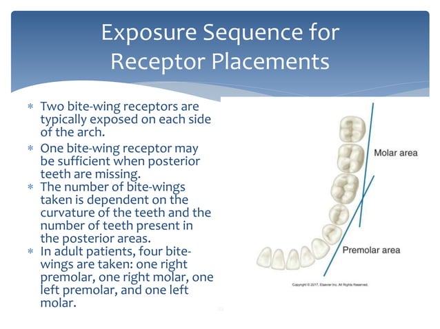 Chapter 19: Bitewing Technique | PPT | Dental Health | Diseases and ...