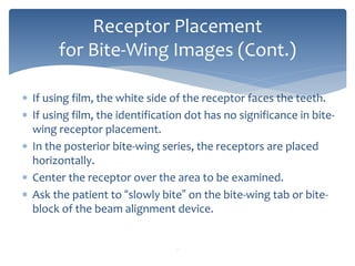 Chapter 19: Bitewing Technique | PPT