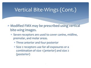 Chapter 19: Bitewing Technique | PPT
