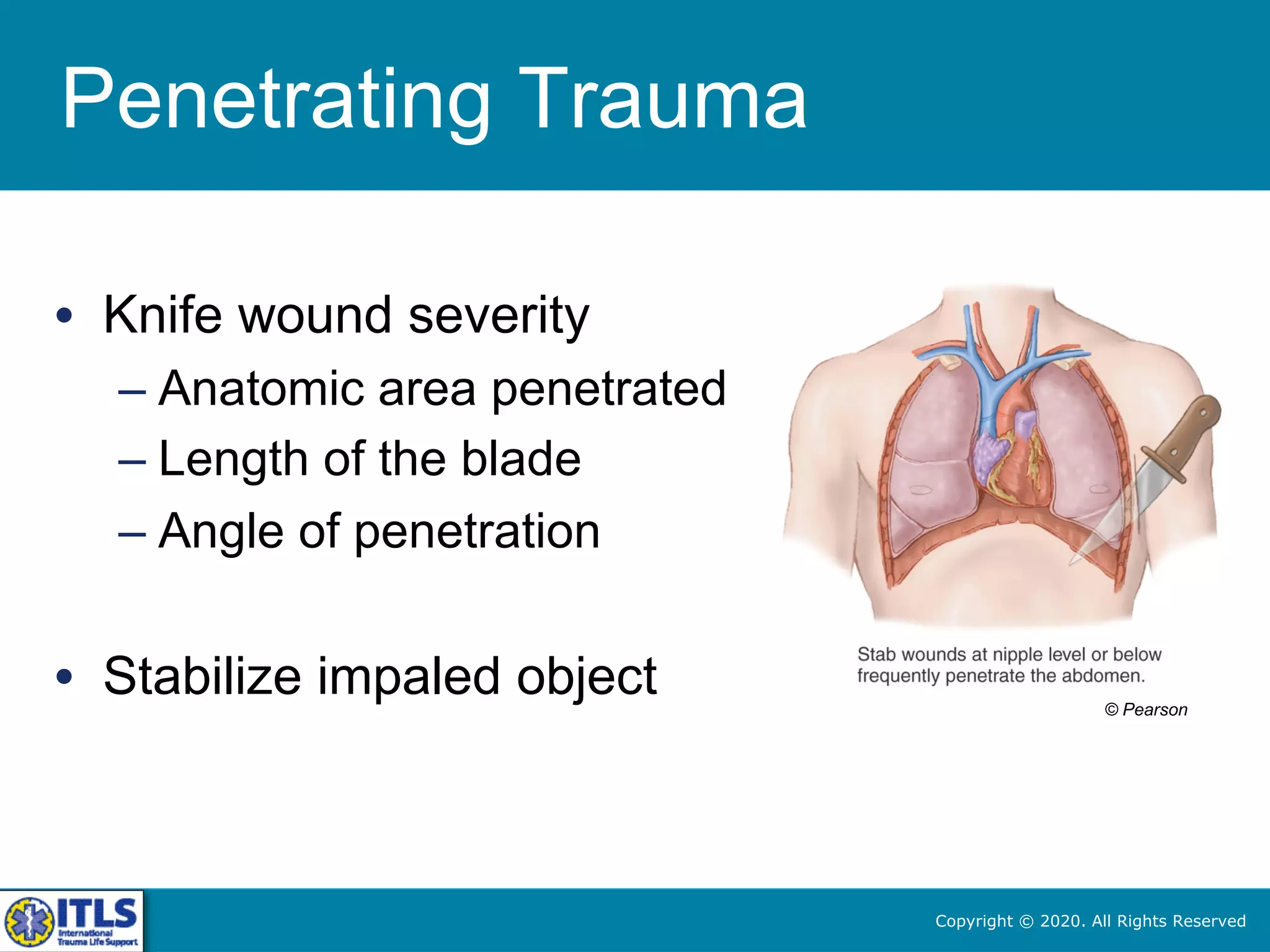 Chapter+01_9th+Edition_ITLS_04-2020.pdf