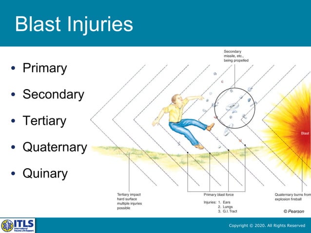Chapter+01_9th+Edition_ITLS_04-2020.pdf | First Aid | Injuries