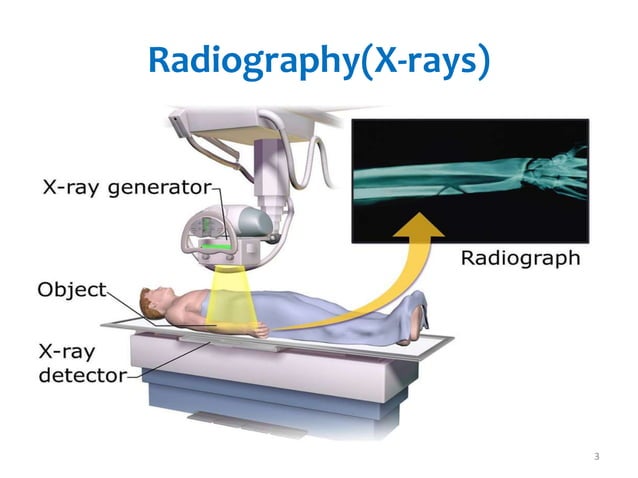 Chapter_03(1)_ X-Ray_Maintenance and troubleshooting.ppt | Medical ...