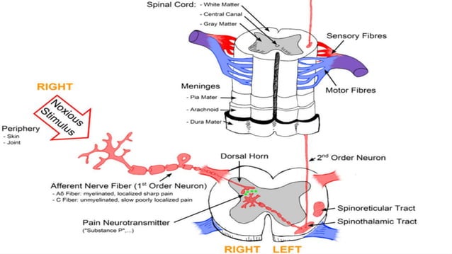 what is Pain? Its types. (Nociceptive & Neuropathic Pain), & acute and ...