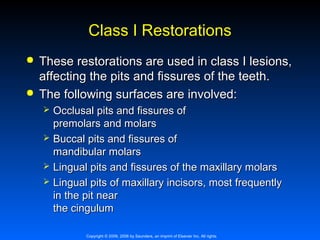 classification of cavity preparation | PPT