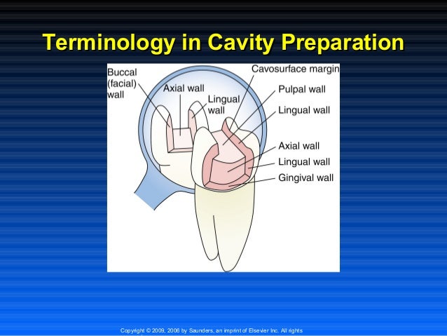 classification of cavity preparation
