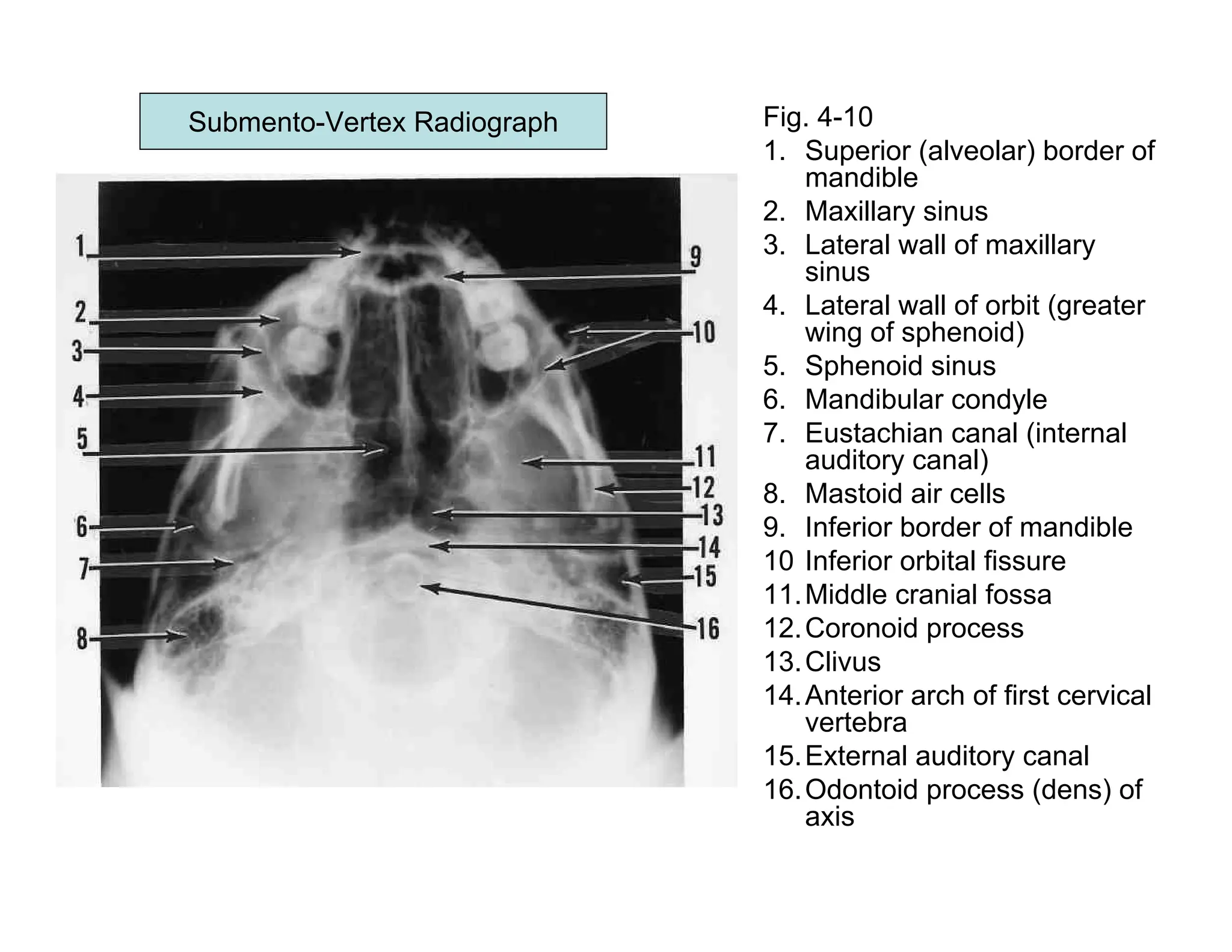 Extraoral and Occlusal Anatomic Landmarks | PDF