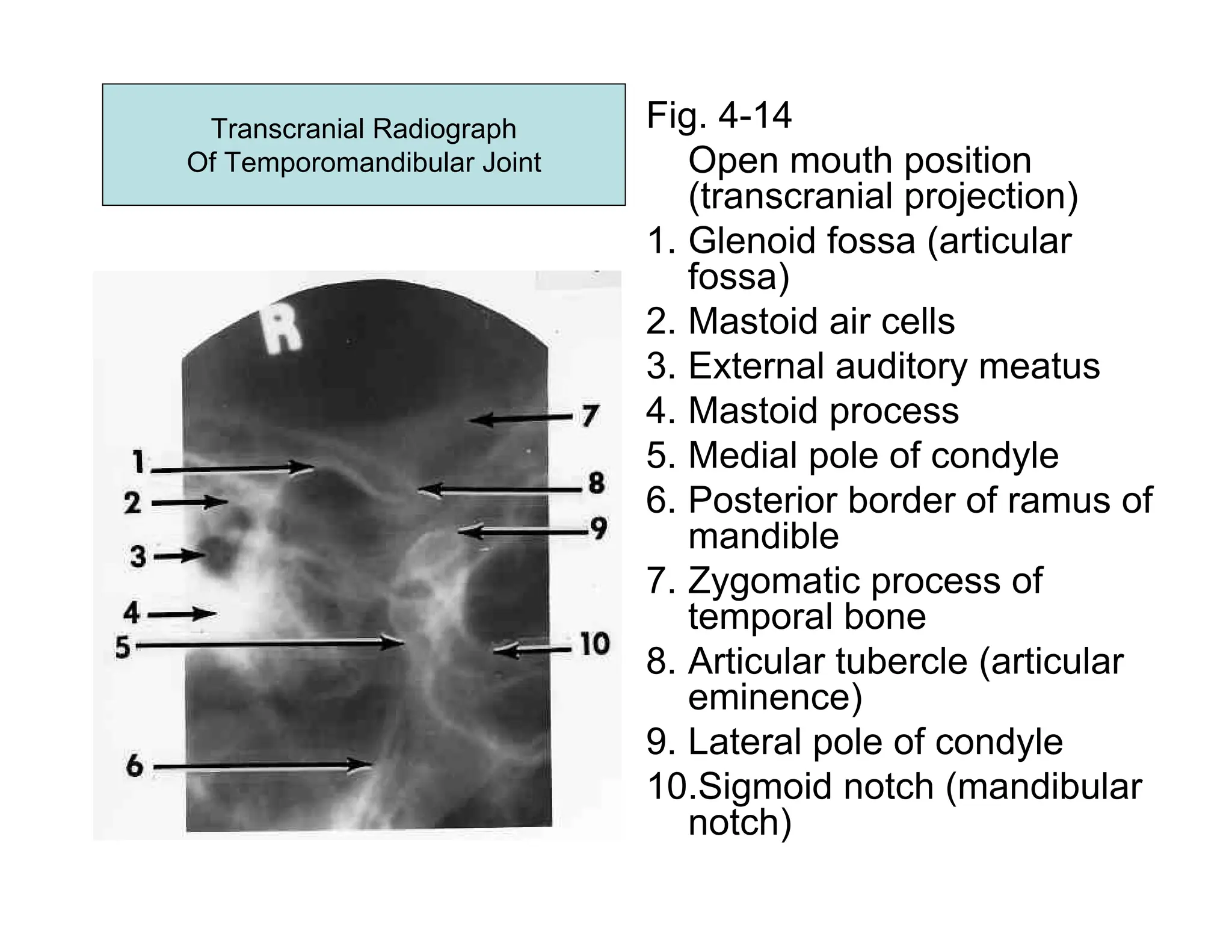Extraoral and Occlusal Anatomic Landmarks | PDF