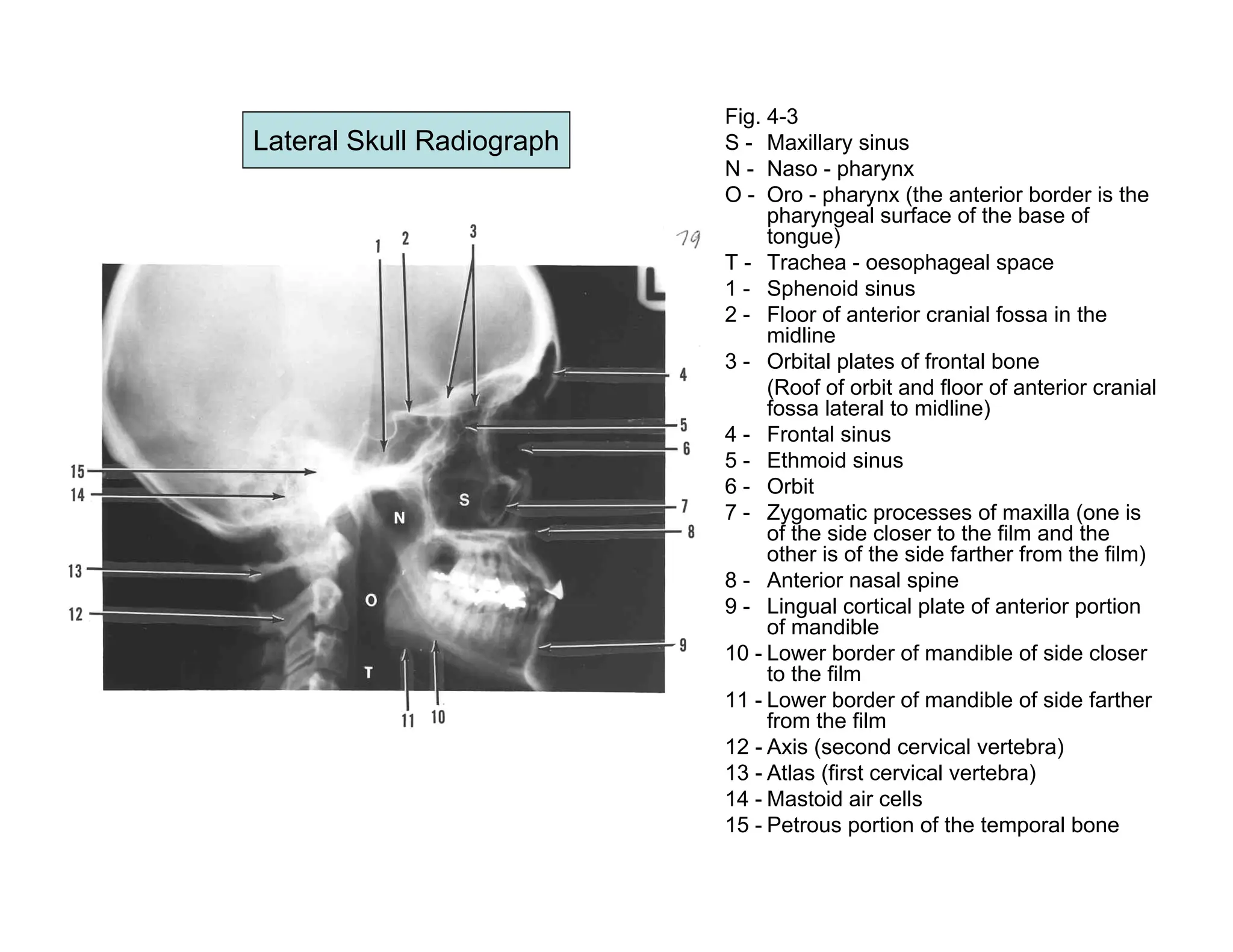 Extraoral and Occlusal Anatomic Landmarks | PDF