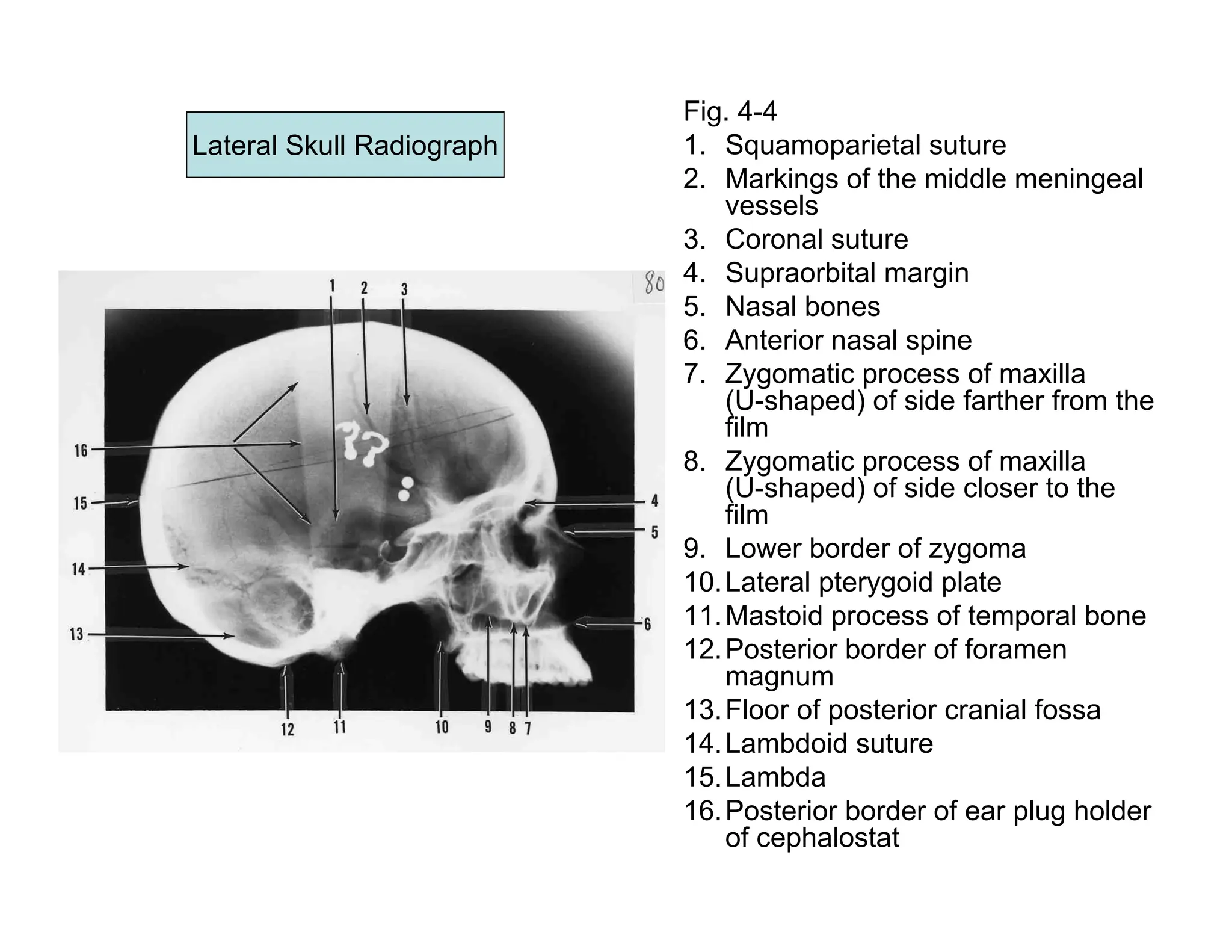 Extraoral and Occlusal Anatomic Landmarks | PDF