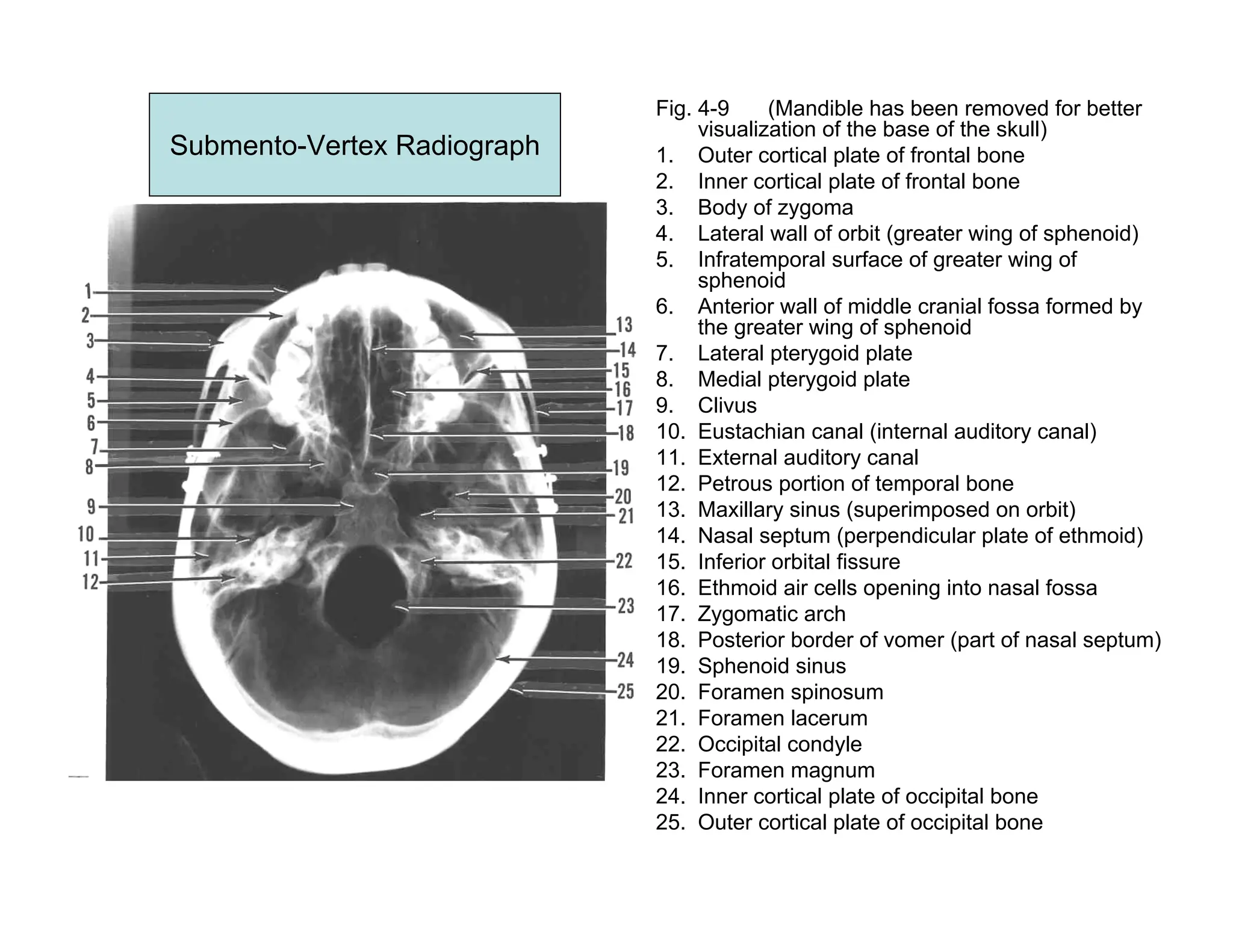 Extraoral and Occlusal Anatomic Landmarks | PDF