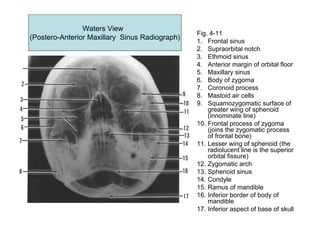 Extraoral and Occlusal Anatomic Landmarks | PDF