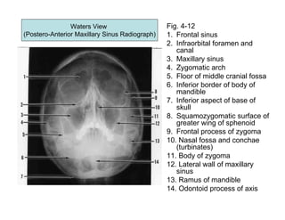 Extraoral and Occlusal Anatomic Landmarks | PDF