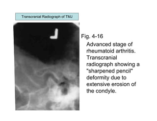 Extraoral and Occlusal Anatomic Landmarks | PDF