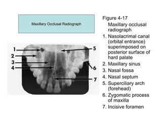 Extraoral and Occlusal Anatomic Landmarks | PDF