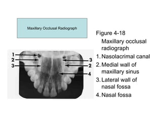 Extraoral and Occlusal Anatomic Landmarks | PPT