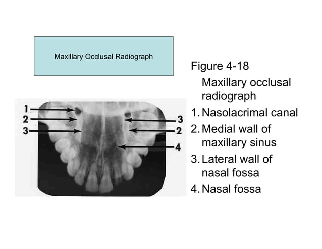 Extraoral and Occlusal Anatomic Landmarks | PPT