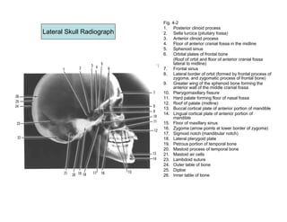 Extraoral and Occlusal Anatomic Landmarks | PDF