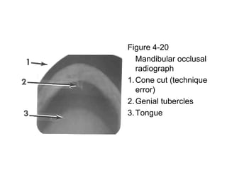 Extraoral and Occlusal Anatomic Landmarks | PDF