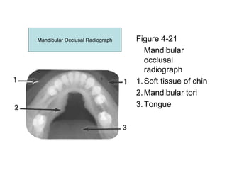Extraoral and Occlusal Anatomic Landmarks | PDF