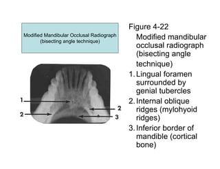 Extraoral and Occlusal Anatomic Landmarks | PDF