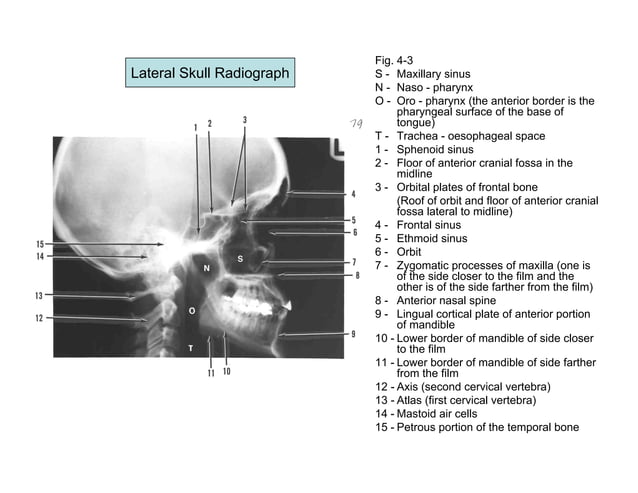 Extraoral and Occlusal Anatomic Landmarks | PDF