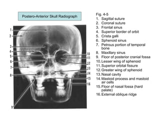 Extraoral and Occlusal Anatomic Landmarks | PDF