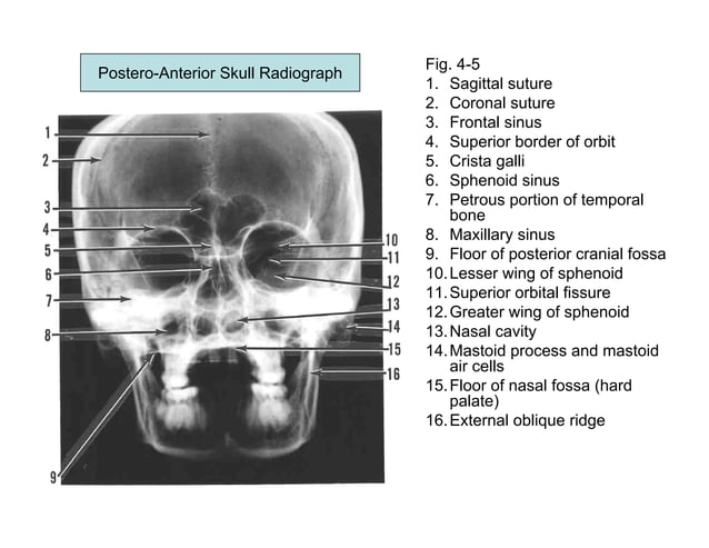 Extraoral and Occlusal Anatomic Landmarks | PPT