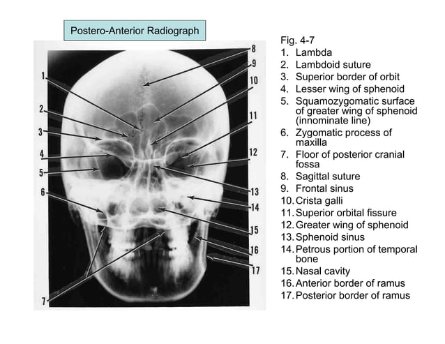 Extraoral and Occlusal Anatomic Landmarks | PPT