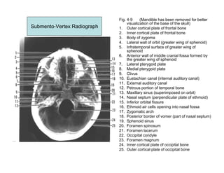 Extraoral and Occlusal Anatomic Landmarks | PDF