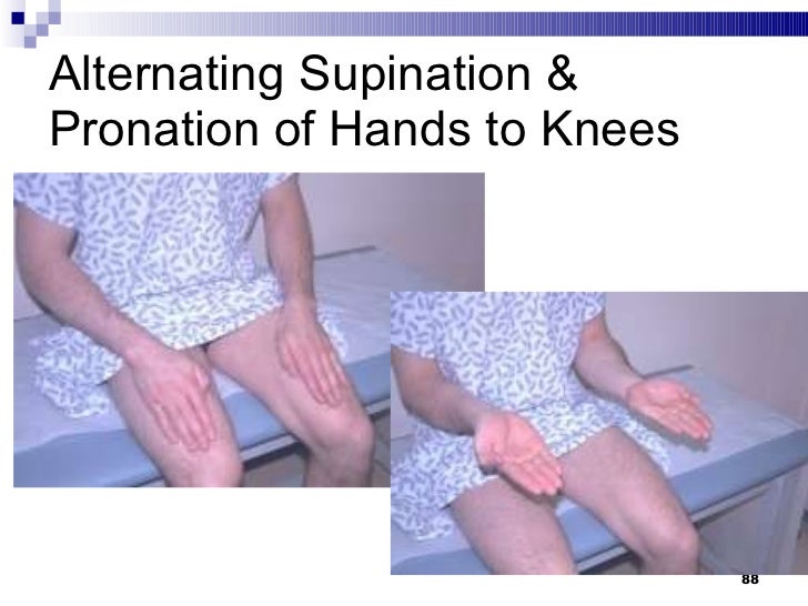 INTRODUCTION TO NEURO NURSING