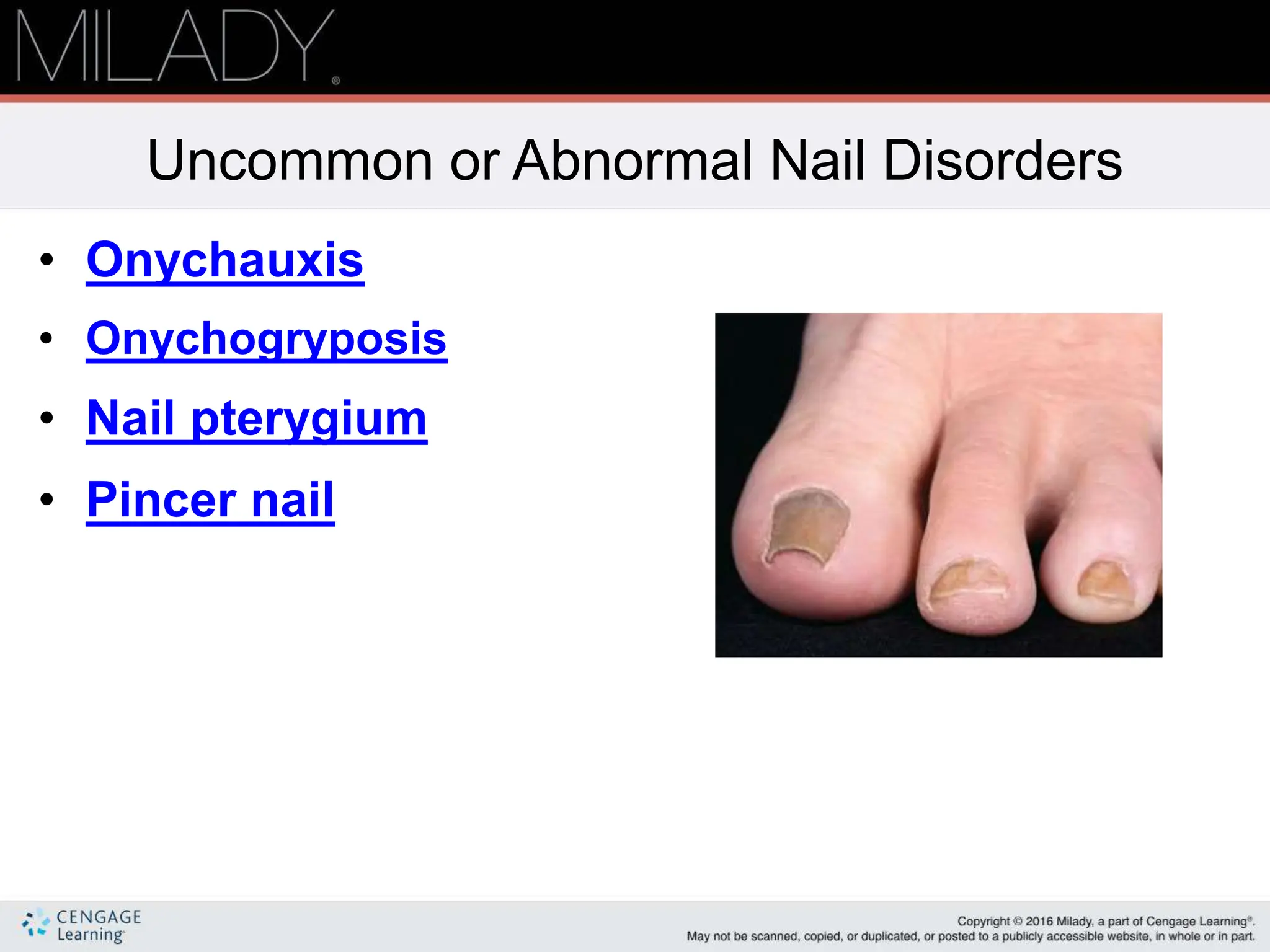 Nail disorders and diseases; Basic Introducion | PPTX