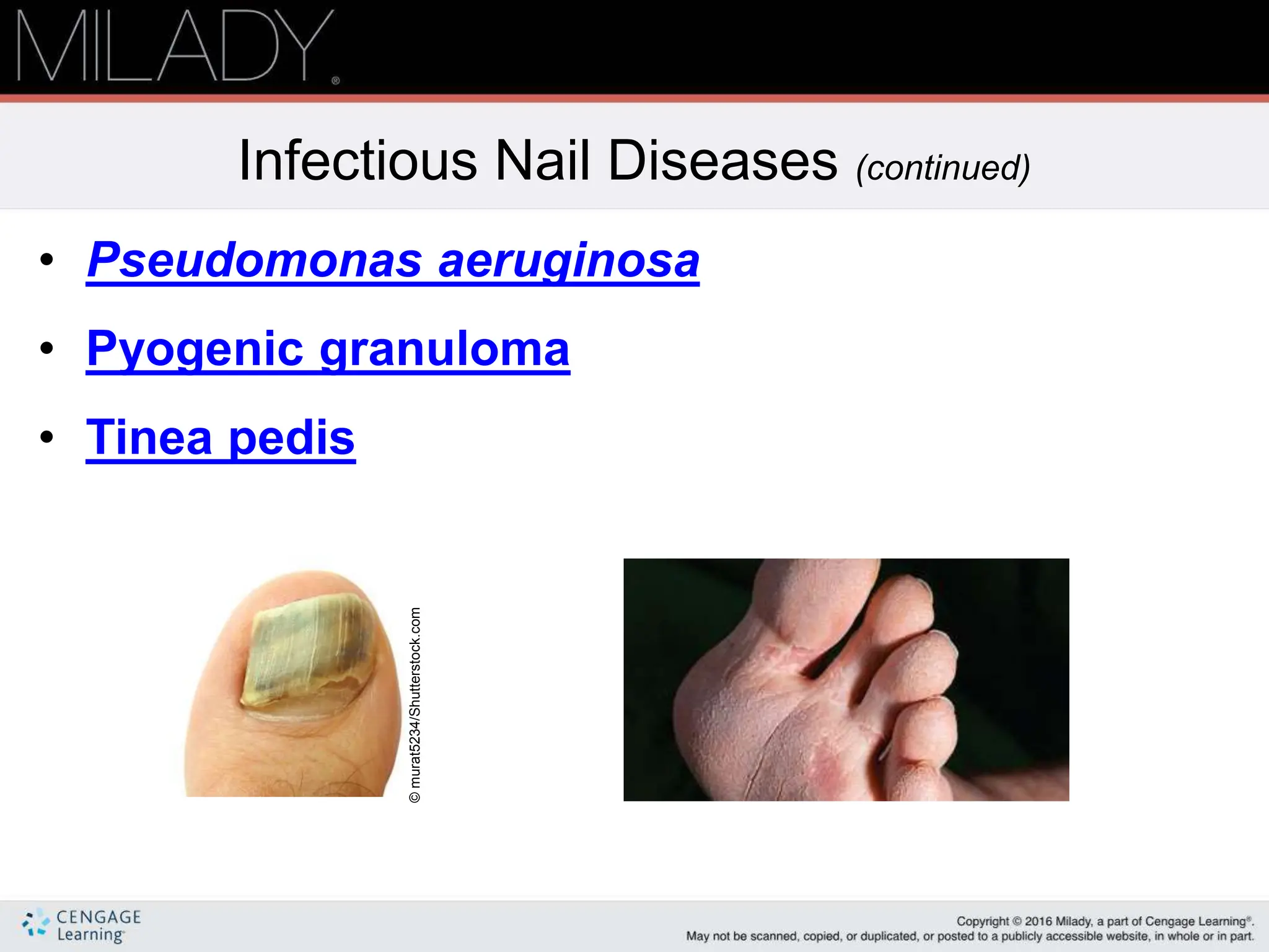 Nail disorders and diseases; Basic Introducion | PPTX