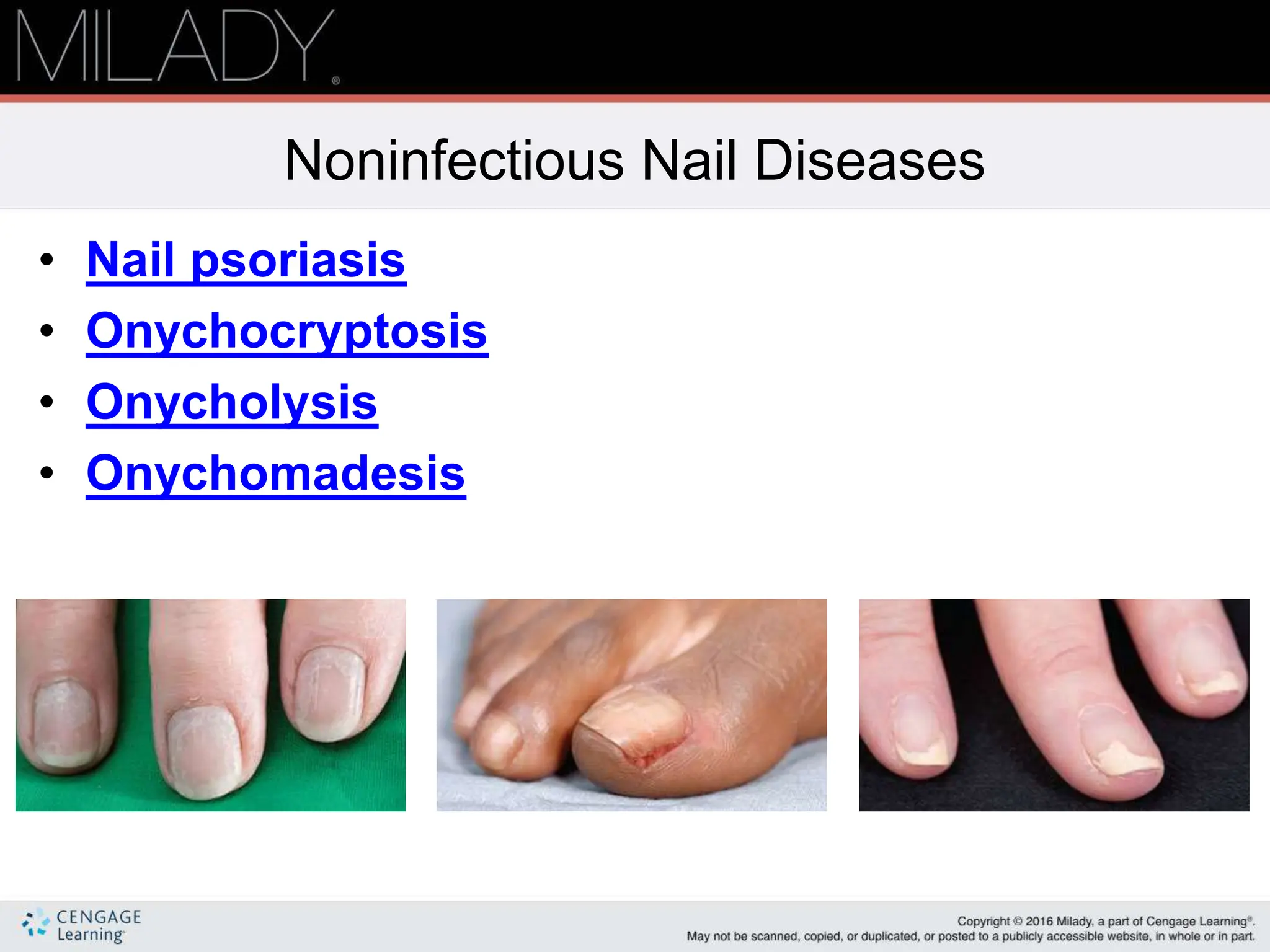 Nail disorders and diseases; Basic Introducion | PPTX