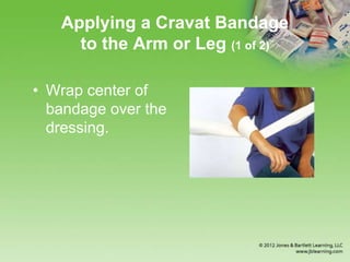 Chapter 10 Bandaging Wounds | PPTX