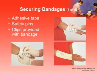 Chapter 10 Bandaging Wounds | PPTX