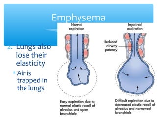 Chapter 10 respiration II | PPT