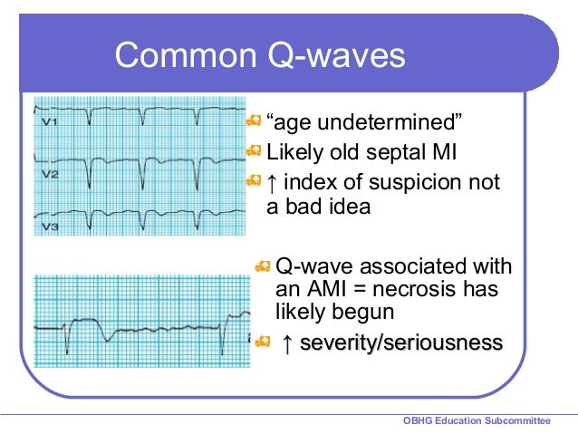 Chapter 10 - 12 lead Interpretation - Part 2