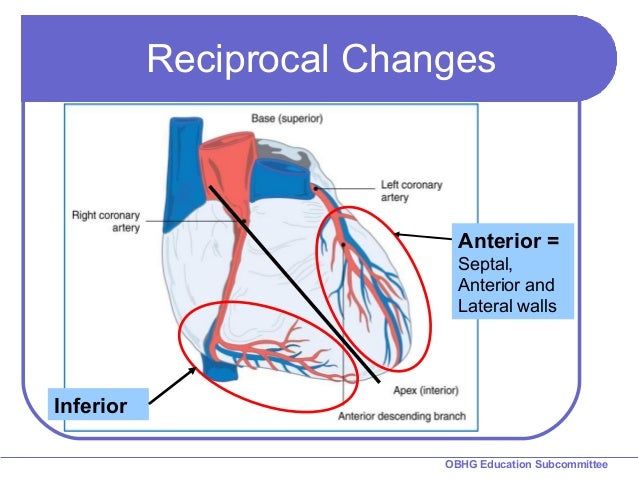 Chapter 10 - 12 lead Interpretation - Part 2