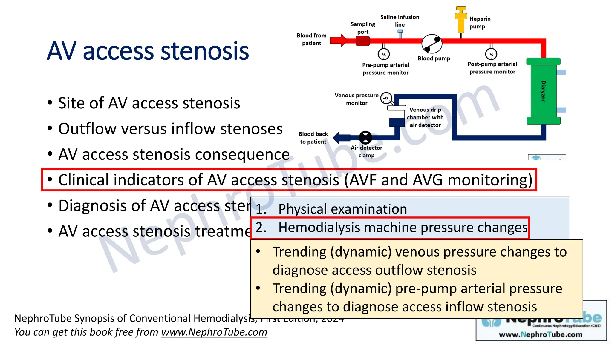 Hemodialysis: Chapter 10, AVF and AVG - Complications (Diagnosis and ...