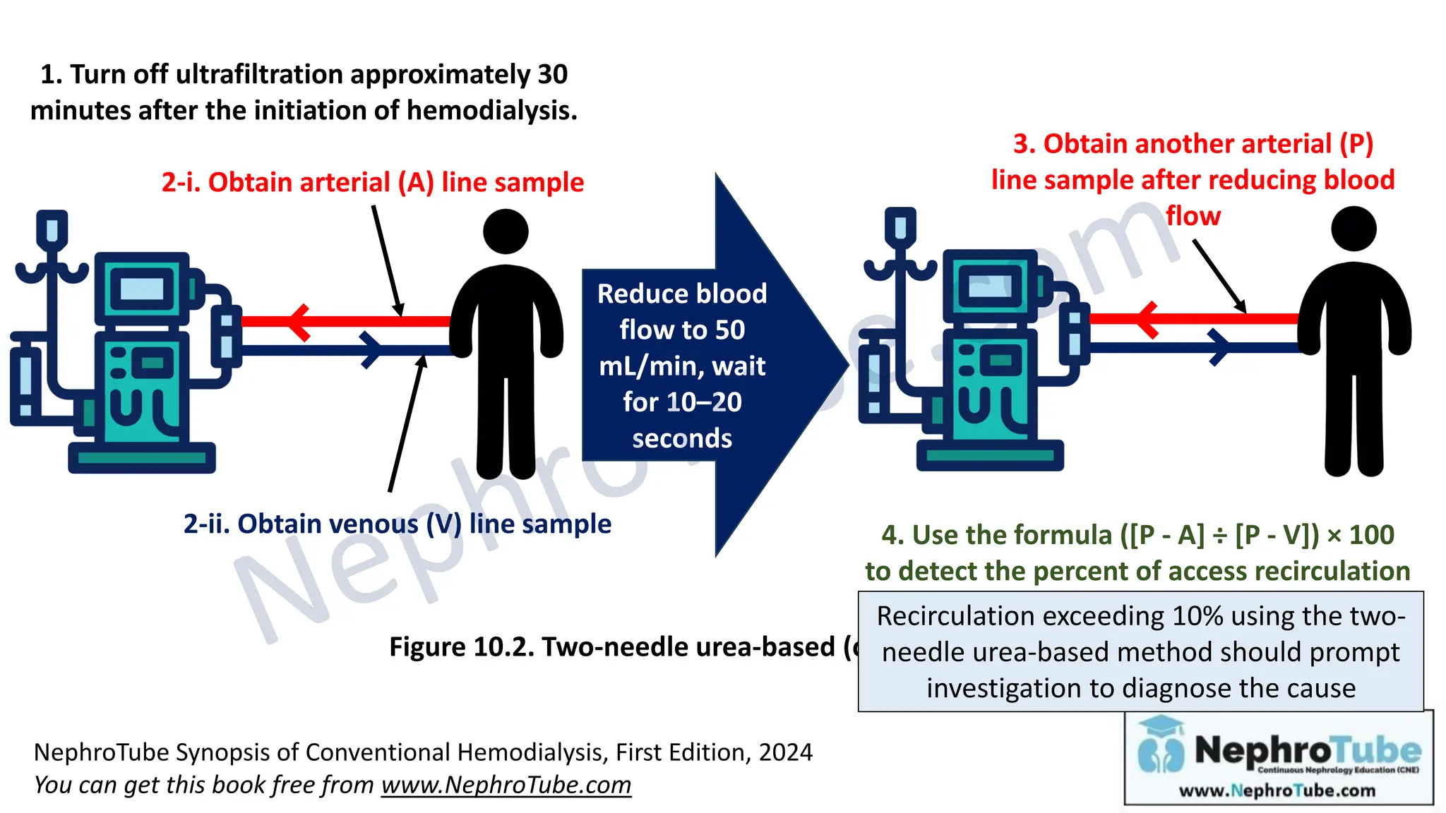 Hemodialysis: Chapter 10, AVF and AVG - Complications (Diagnosis and ...