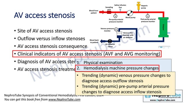 Hemodialysis: Chapter 10, AVF and AVG - Complications (Diagnosis and ...