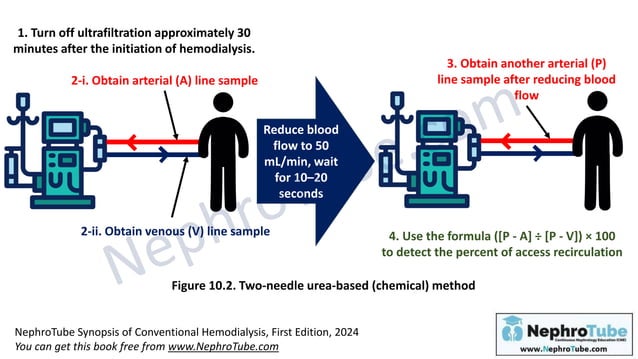 Hemodialysis: Chapter 10, AVF and AVG - Complications (Diagnosis and ...