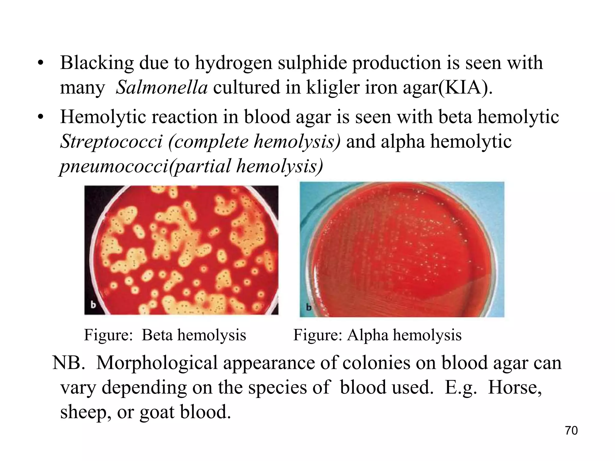 Chapter 10 Culture media preparation, inoculation.ppt