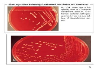 Chapter 10 Culture media preparation, inoculation.ppt