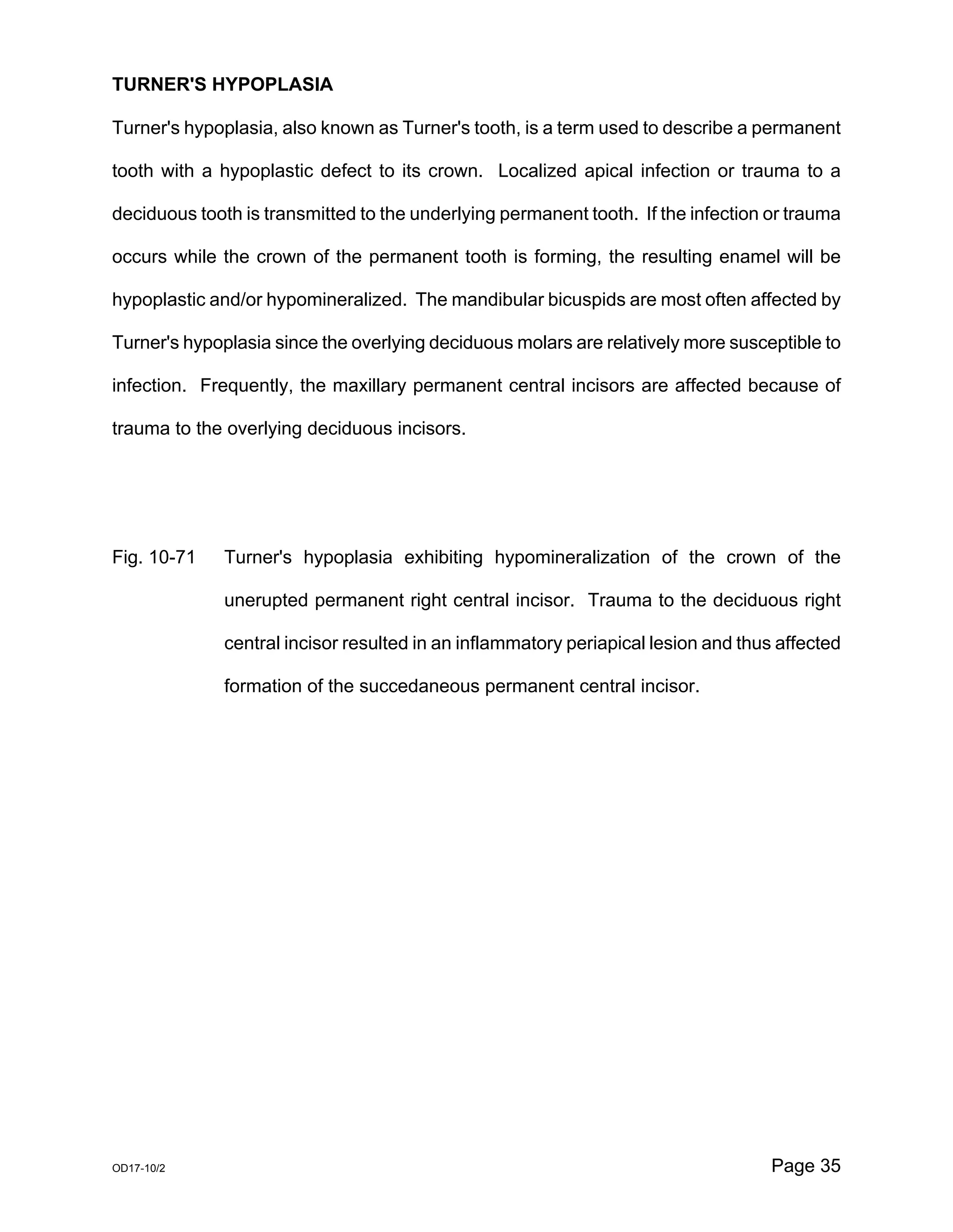 dental anomalies | PDF