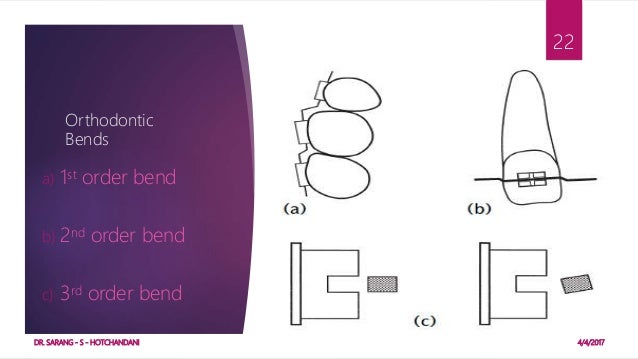 Fixed Orthodontic Appliance (Dentistry) #Braces