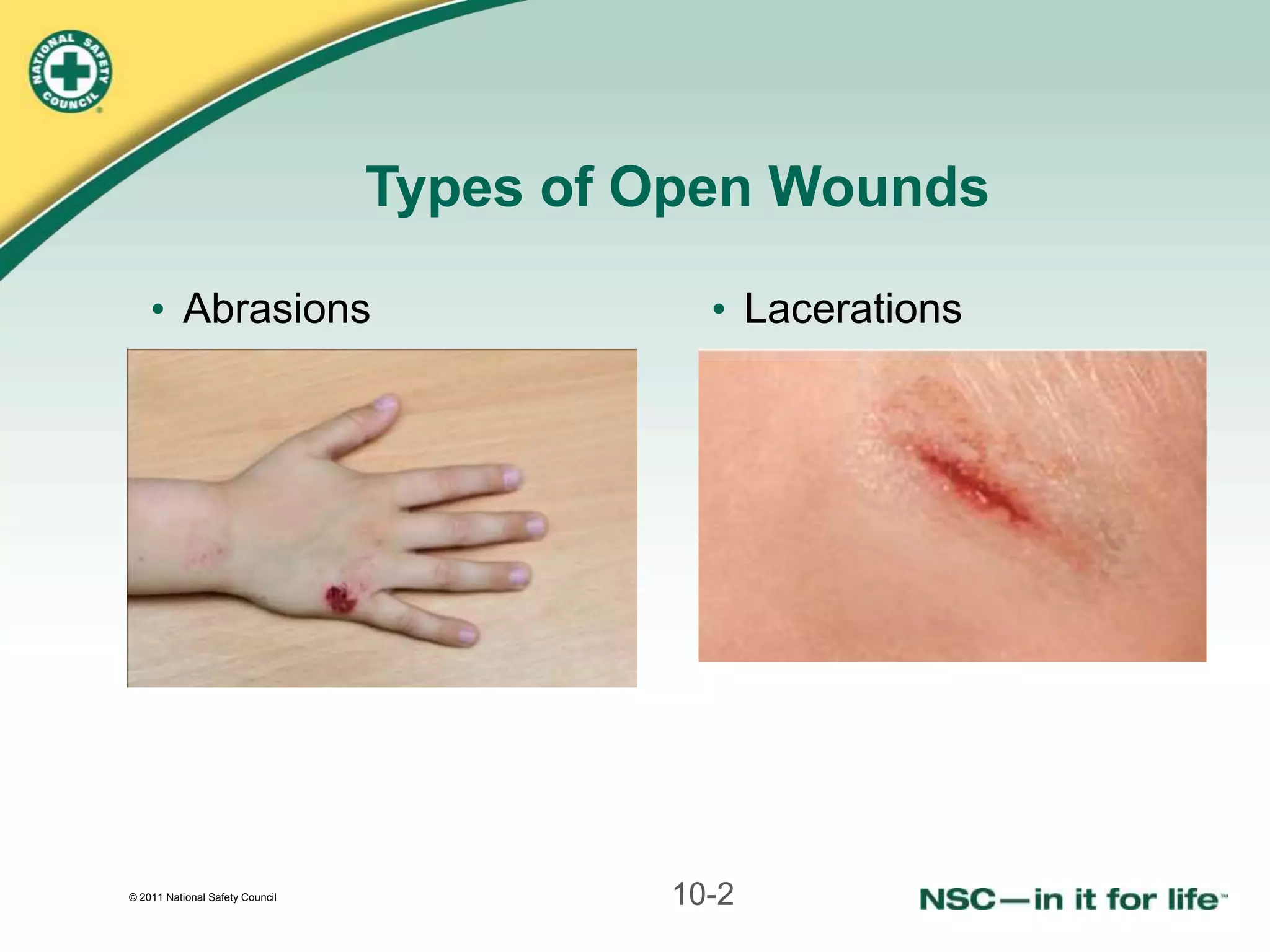Chapter 10 Soft tissue.ppt