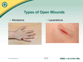 Chapter 10 Soft tissue.ppt