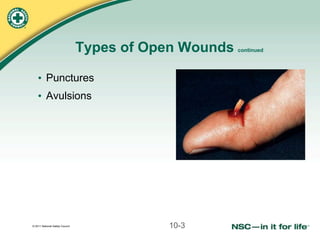 Chapter 10 Soft tissue.ppt