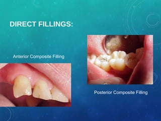 Introduction to dental materials | PPT